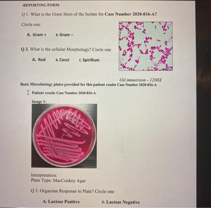 Solved Name: Clinical Case Study Microbiology Case Number | Chegg.com