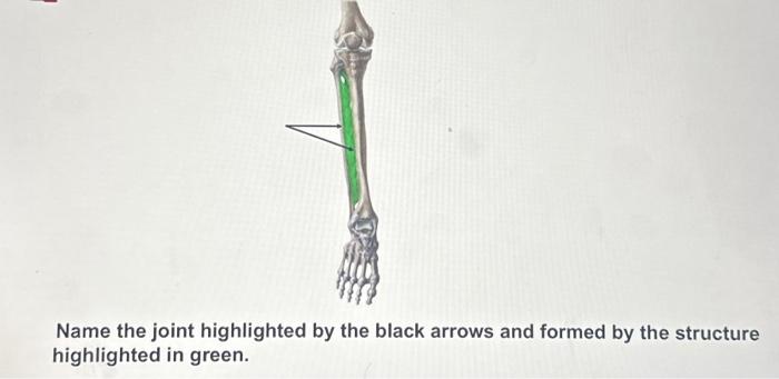 Solved Identify the surface highlighted in green and | Chegg.com