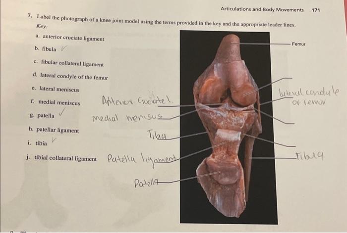 7. Label the photograph of a knee joint model using | Chegg.com 7. Label the photograph of a knee joint model using | Chegg.com