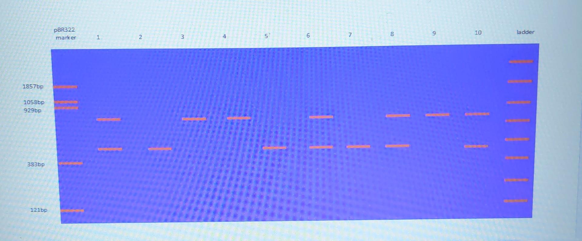 Solved PBR322 marker 10 8 9 ladder 1 2 7 3 5 4 6 1857bp | Chegg.com