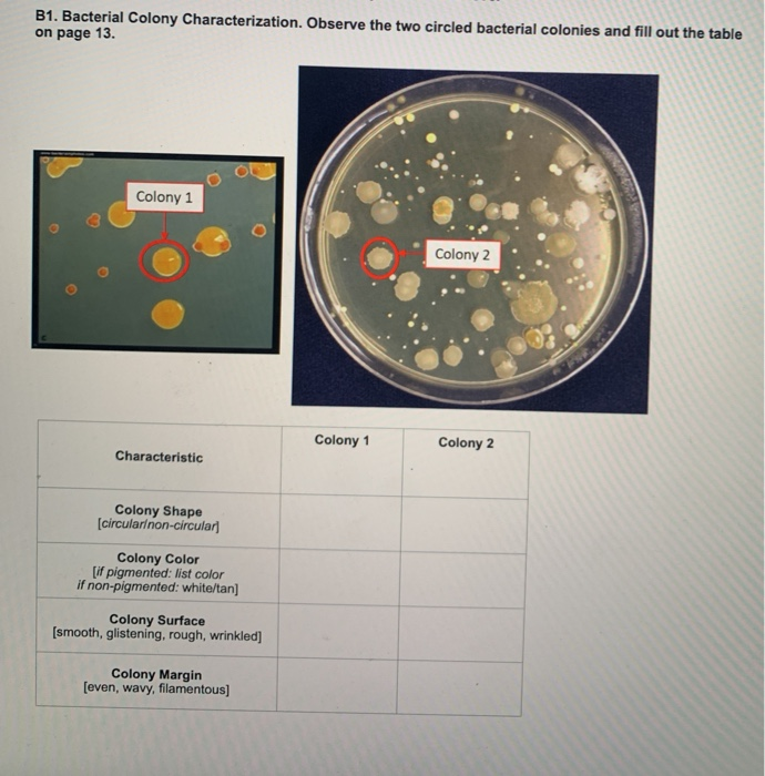 Solved B1. Bacterial Colony Characterization. Observe the | Chegg.com