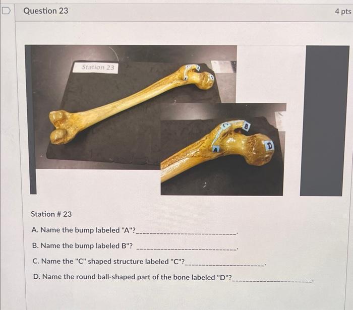 Solved Station \# 23 A. Name the bump labeled "A"? B. Name | Chegg.com