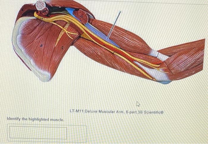 Solved LT-M11:Deluxe Muscular Arm 6-part 3B Scientific | Chegg.com