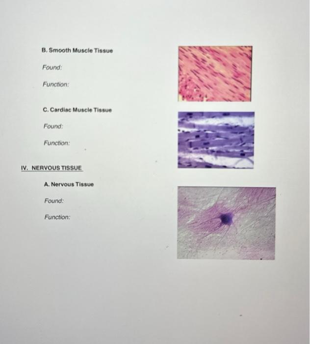 Solved B. Smooth Muscle Tissue Found: Function: C. Cardiac | Chegg.com