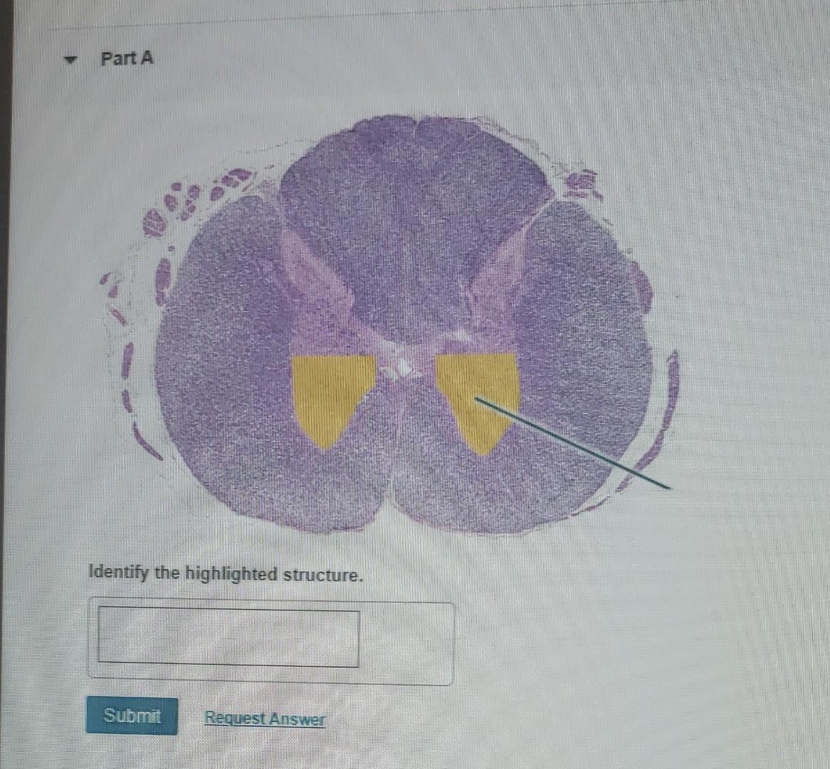 Solved Identify the highlighted structures. Identify the | Chegg.com