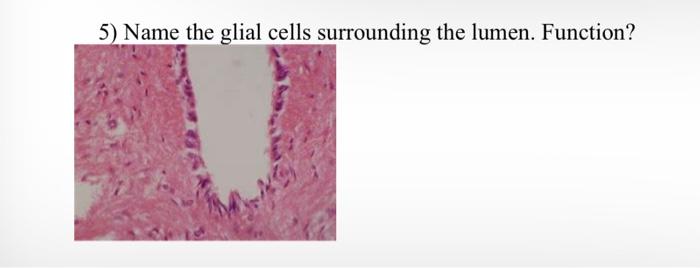 Solved 5) Name the glial cells surrounding the lumen. | Chegg.com