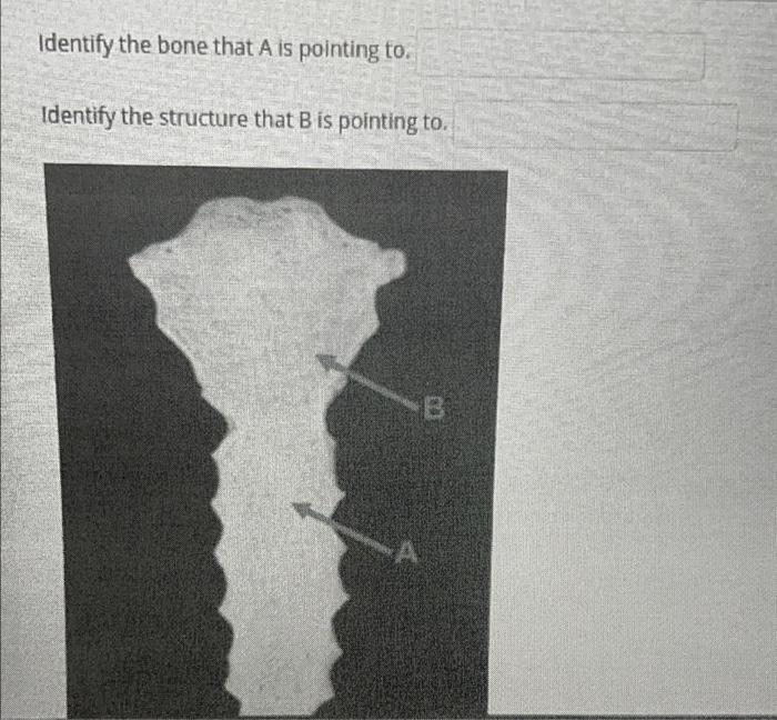 Solved Identify the bone that A is pointing to. Identify the | Chegg.com