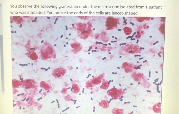 Solved You observe the following gram-stain under the | Chegg.com