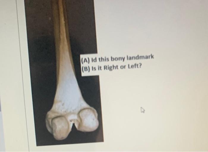 Solved Question 14 Id the bony landmarks indicated by the | Chegg.com