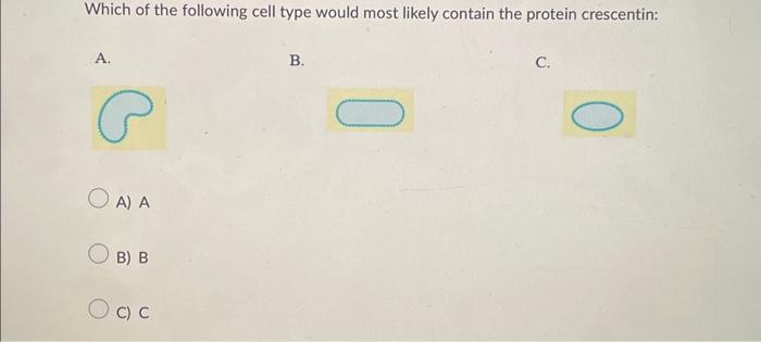Solved Which of the following cell type would most likely | Chegg.com
