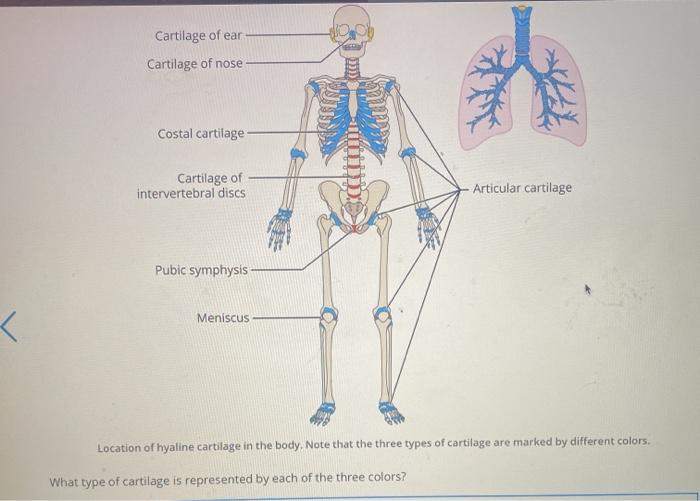 Solved Cartilage of ear Cartilage of nose Costal cartilage | Chegg.com