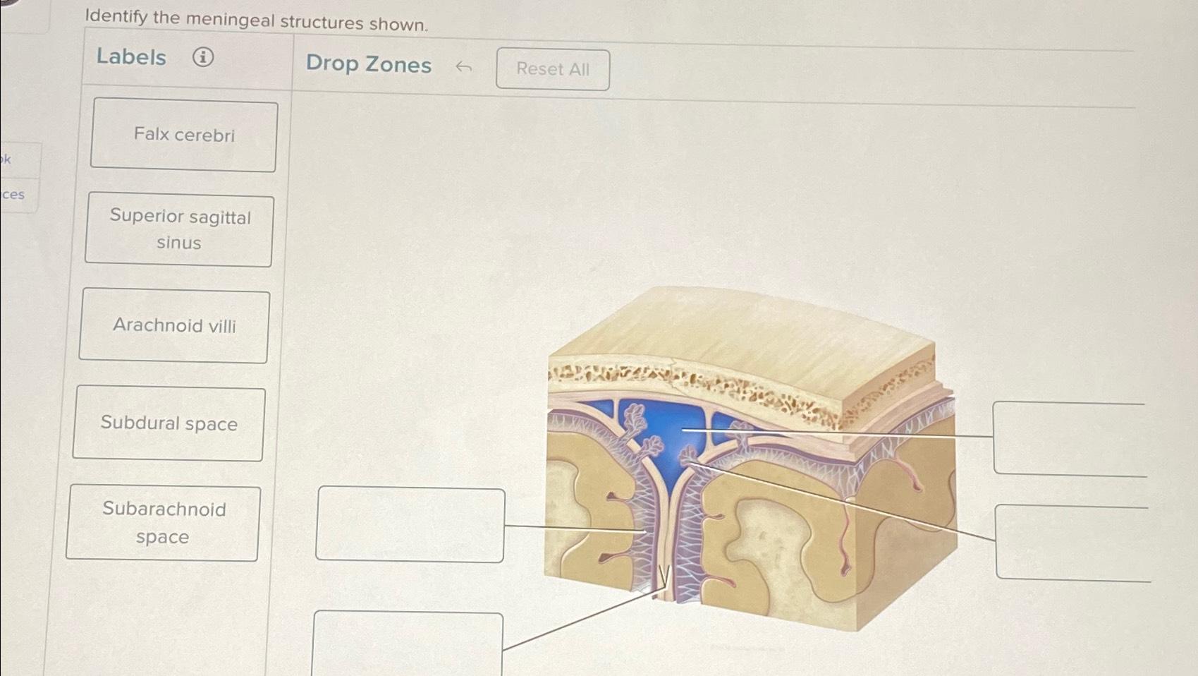 Solved Identify the meningeal structures shown.Labels(i)Drop | Chegg.com
