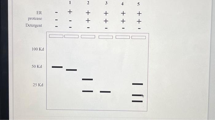 At left are a set of protein arrangements in the ER | Chegg.com
