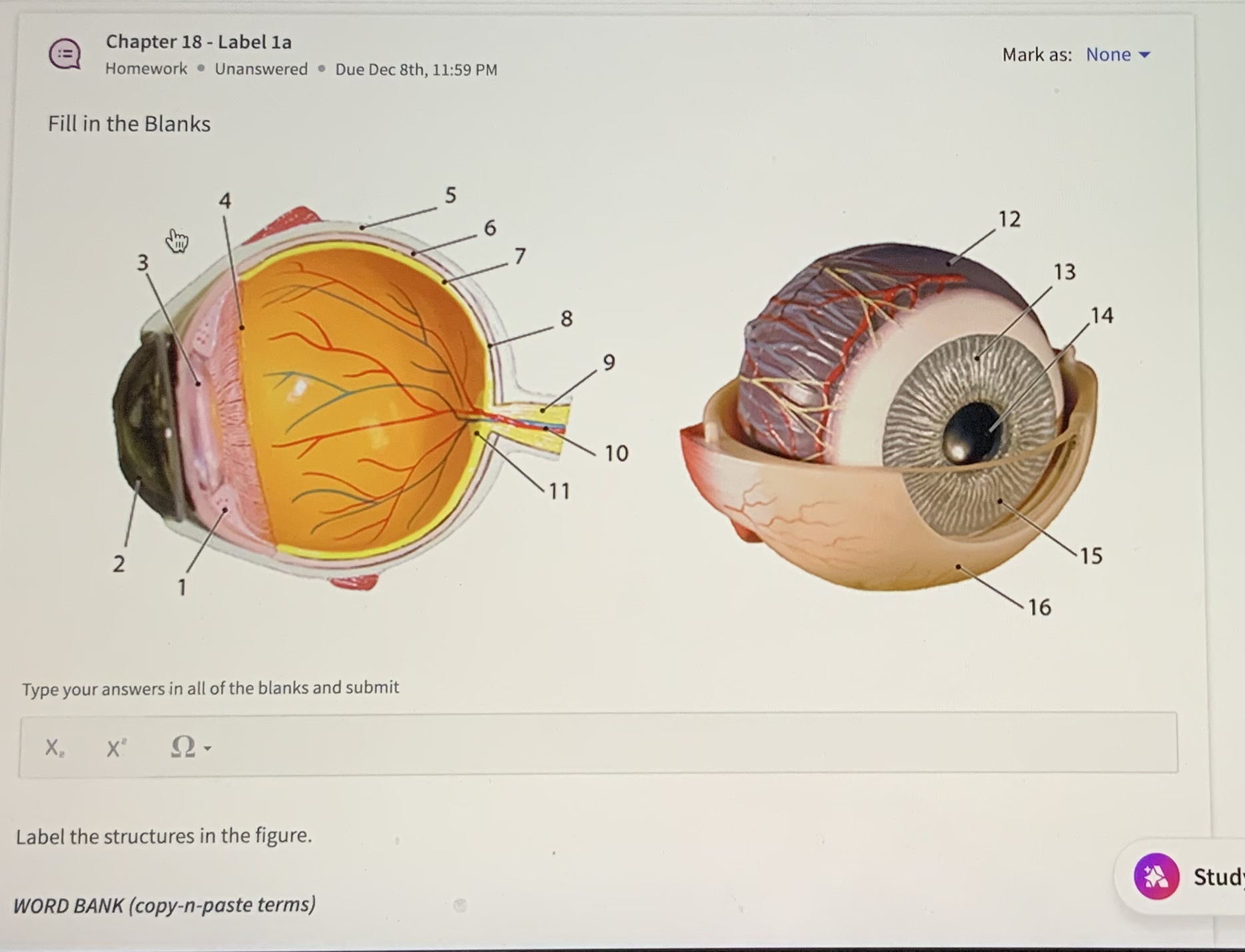 Solved Chapter 18 - ﻿Label 1aHomework • ﻿Unanswered • ﻿Due | Chegg.com