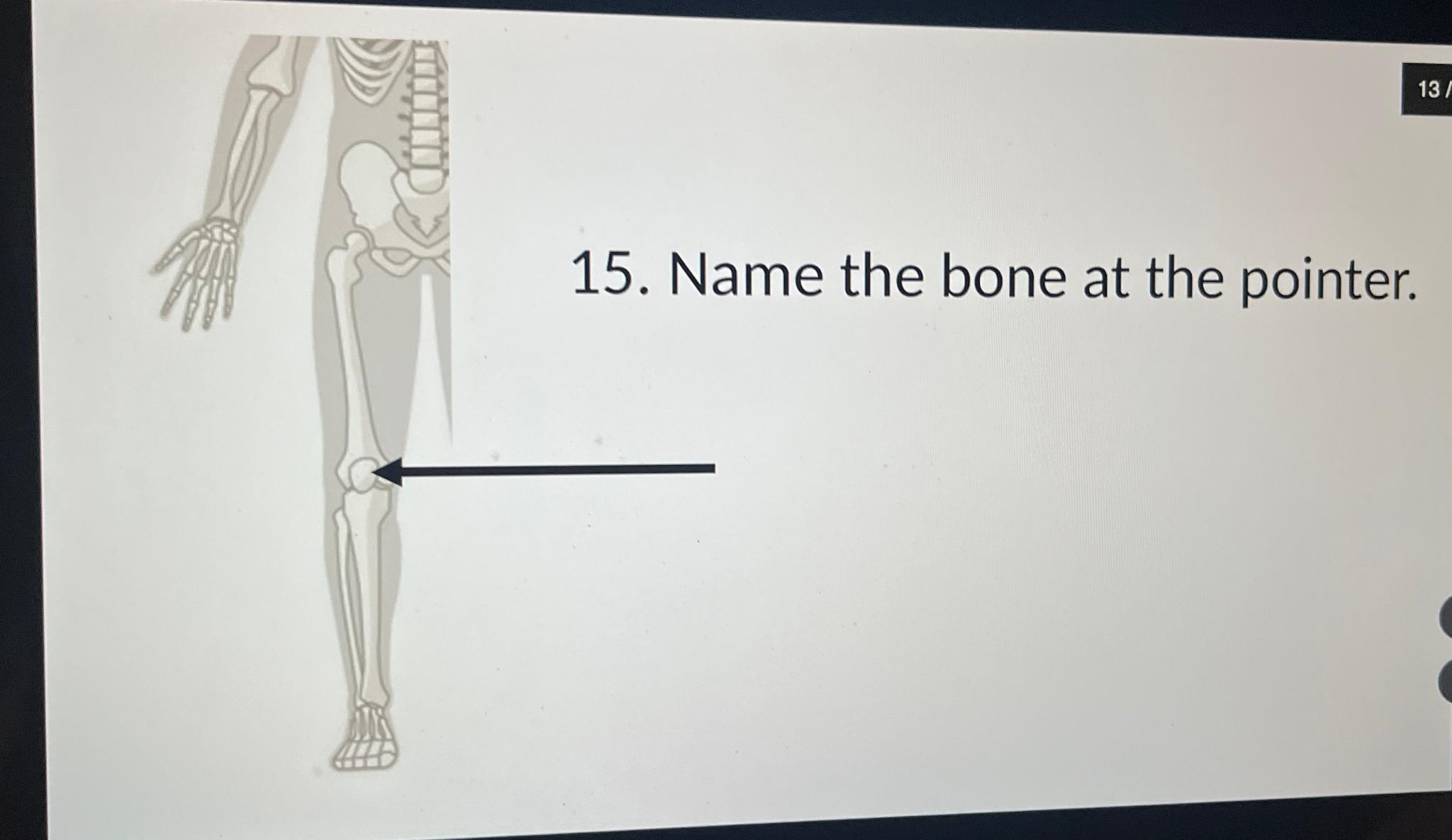 Solved Name the bone at the pointer. | Chegg.com