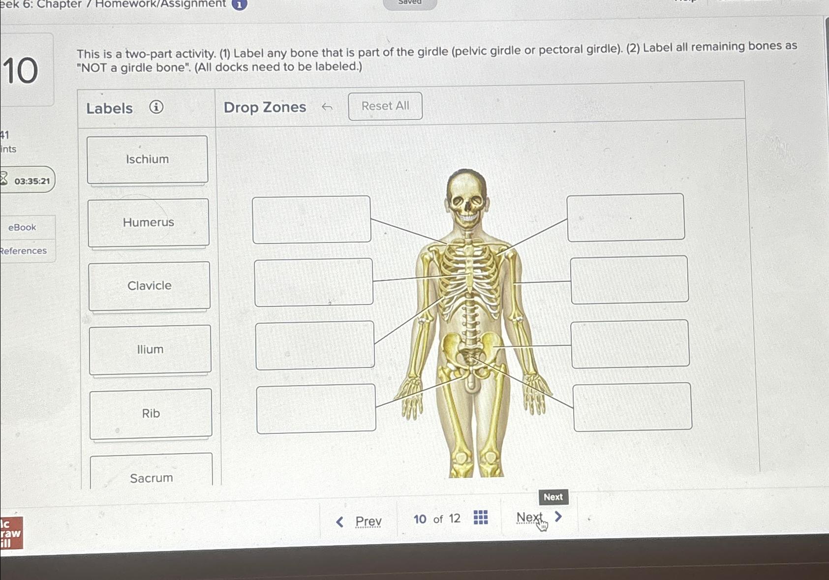Solved 10This is a two-part activity. (1) ﻿Label any bone | Chegg.com