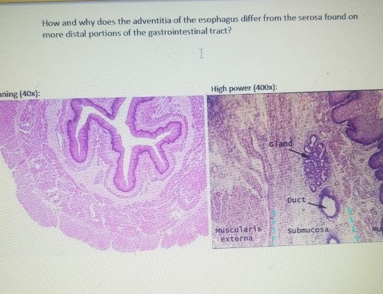 Solved How and why does the adventitia of the esophagus | Chegg.com