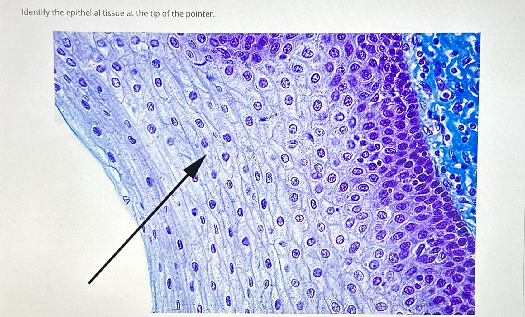 Solved Identify the epithelial tissue at the tip of the | Chegg.com