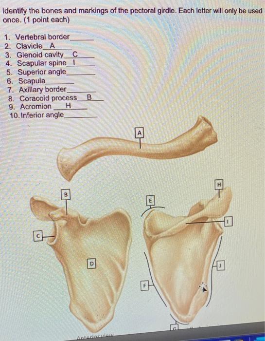 Solved Identify the bones and markings of the pectoral | Chegg.com