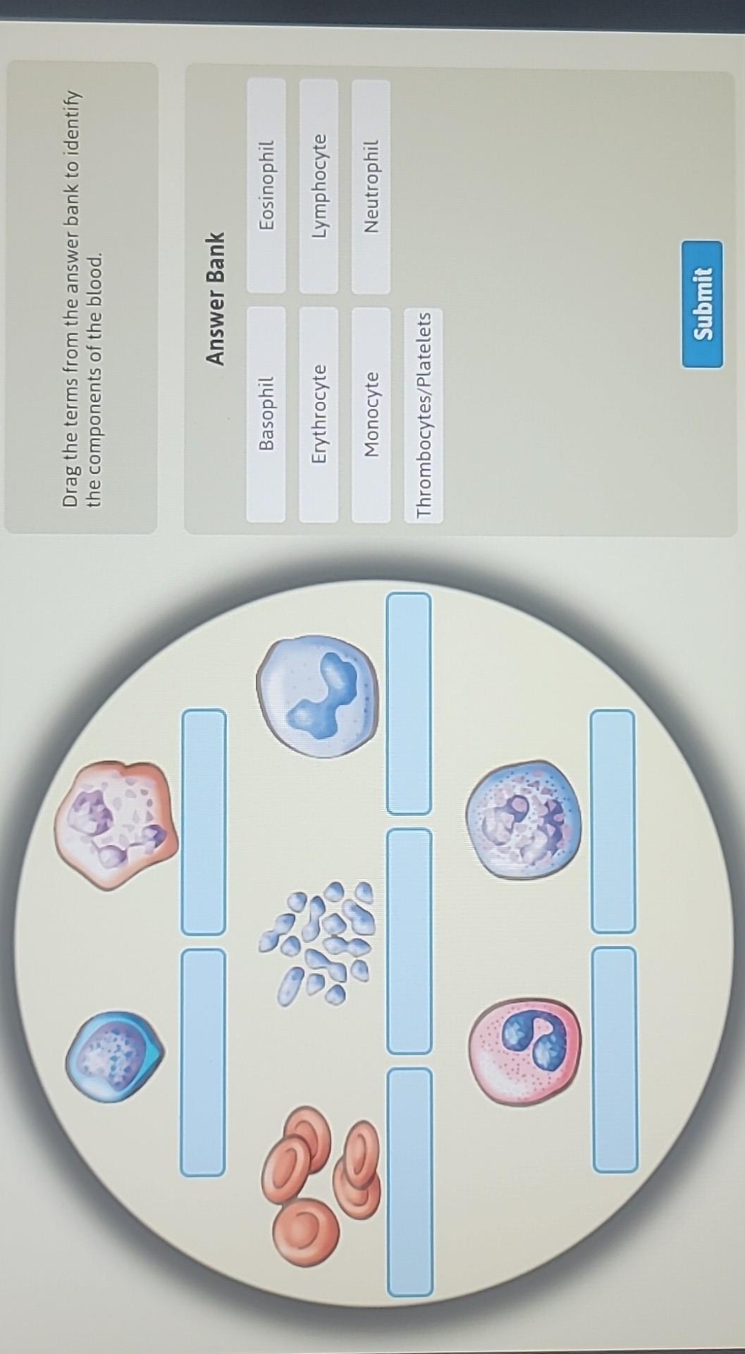 Solved Drag the terms from the answer bank to identify the | Chegg.com