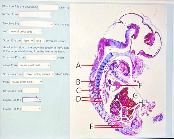 Solved Structure A is the developing which is formed from | Chegg.com