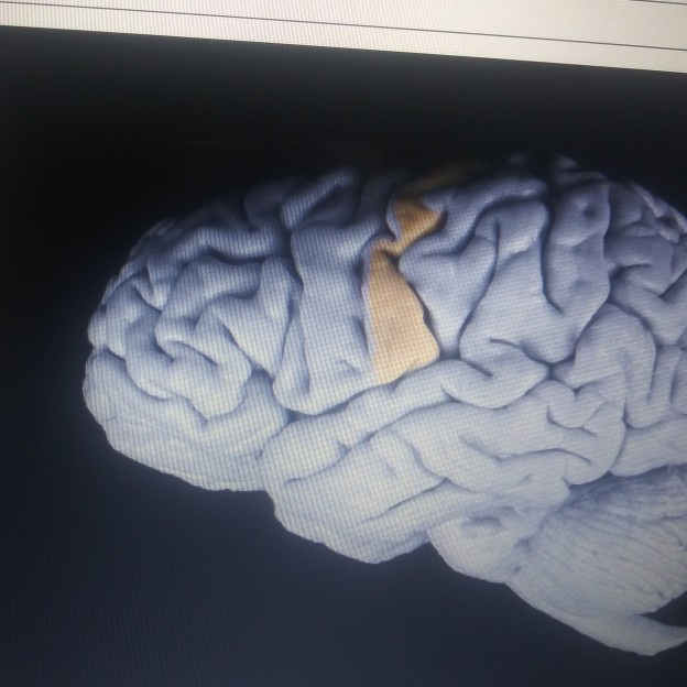 Solved identify the highlighted meninx brain | Chegg.com