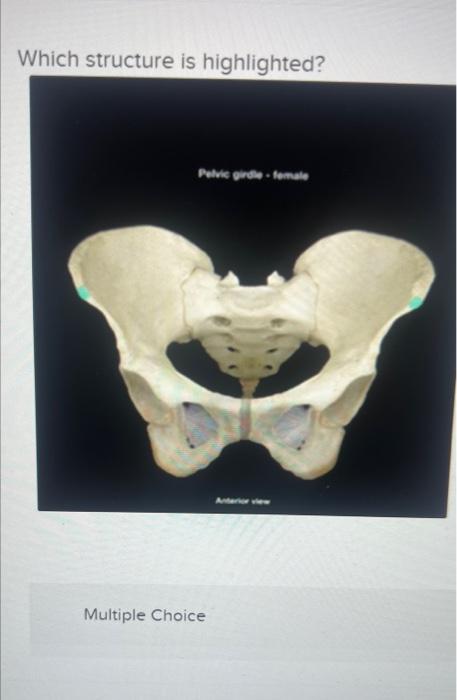 Which structure is hiahliahted? Multiple | Chegg.com