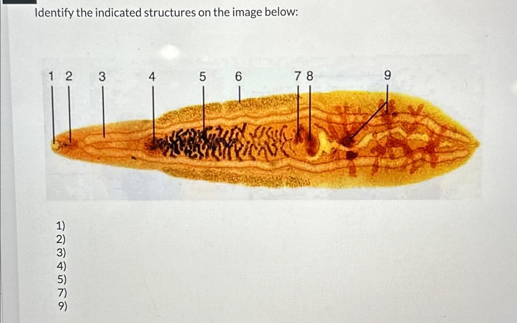 Solved Identify the indicated structures on the image | Chegg.com