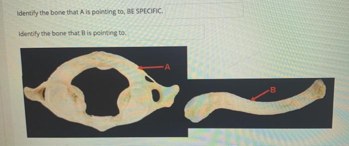 Solved identify the bone that A is pointing to BE SPECIFIC. | Chegg.com