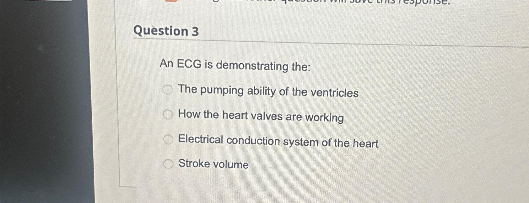 Solved Question 3An ECG is demonstrating the:The pumping | Chegg.com