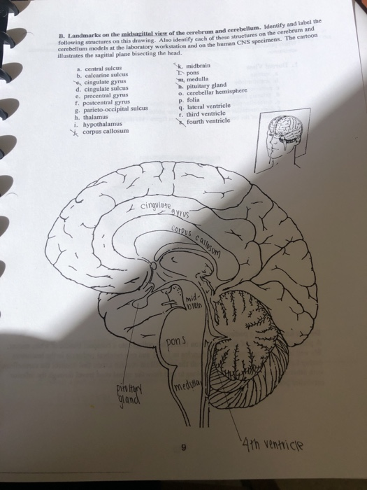 Solved B. Landmarks on the midsagittal view of the cerebrum | Chegg.com