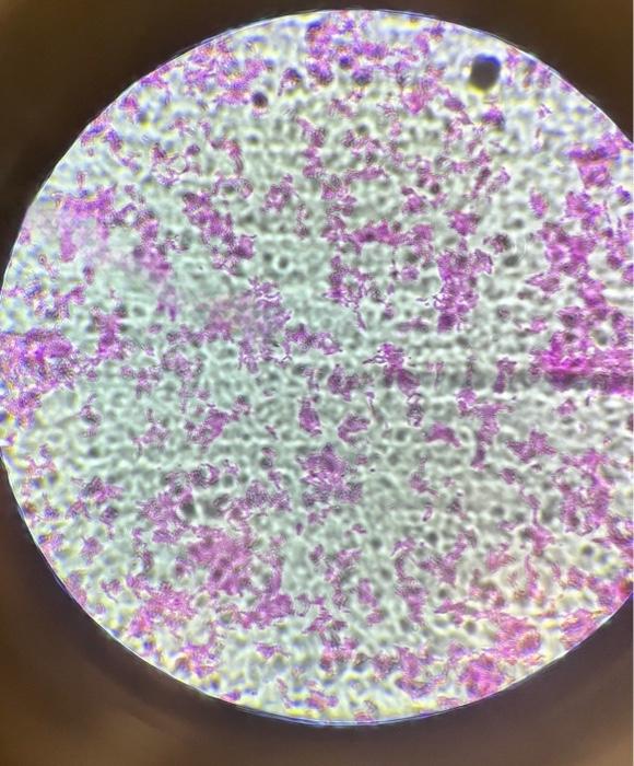 Solved Observing Bacterial Cells 1. Obtain one prepared | Chegg.com