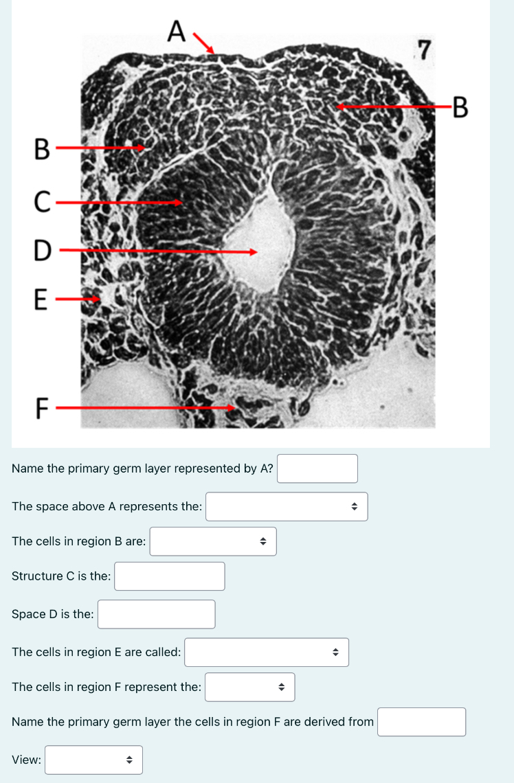 Name the primary germ layer represented by A?The | Chegg.com