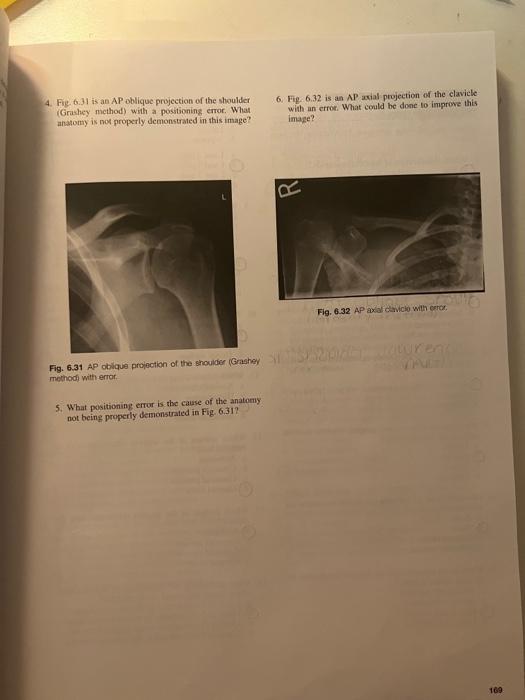 Solved 4. Fig. 6.31 is an AP oblique projection of the | Chegg.com