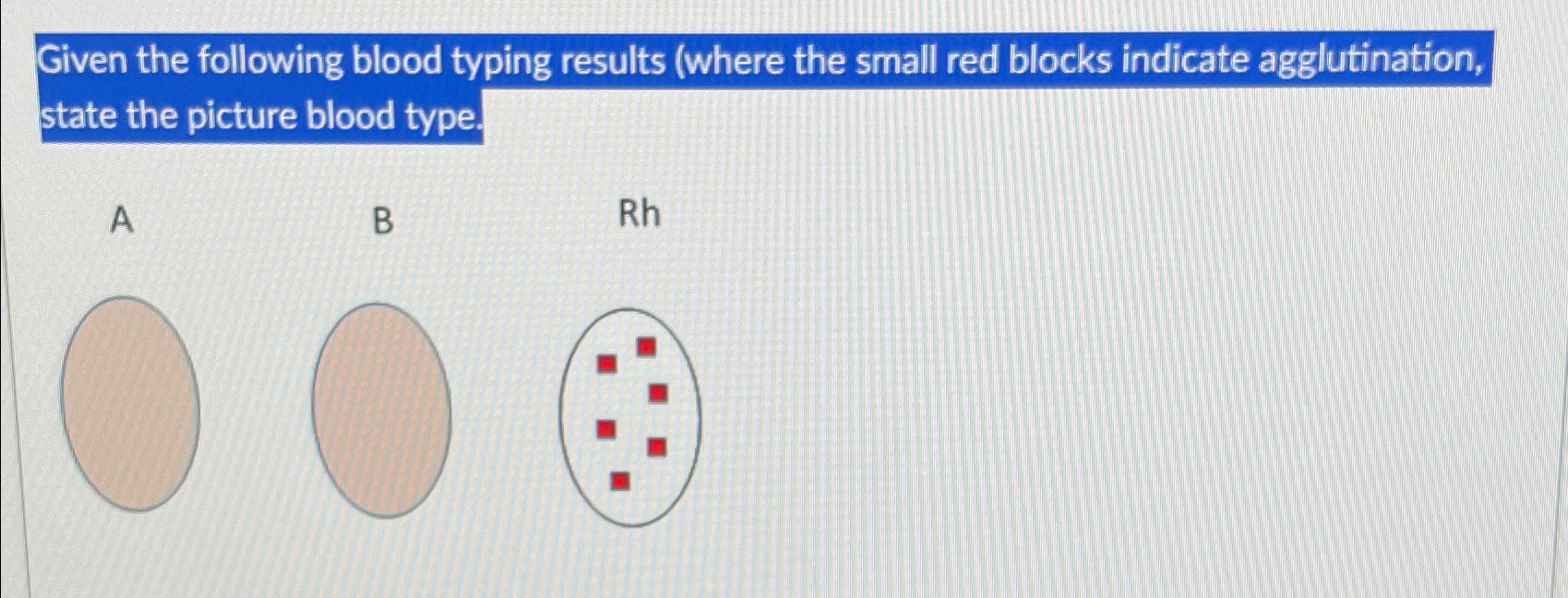Solved Given the following blood typing results (where the | Chegg.com