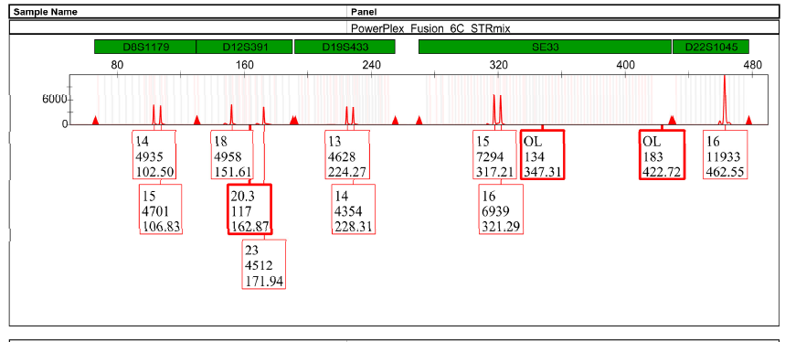 Solved In the following electropherogram, the DNA analyst | Chegg.com