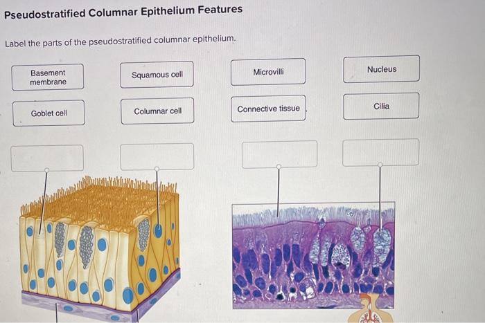 Solved Pseudostratified Columnar Epithelium Features Label | Chegg.com