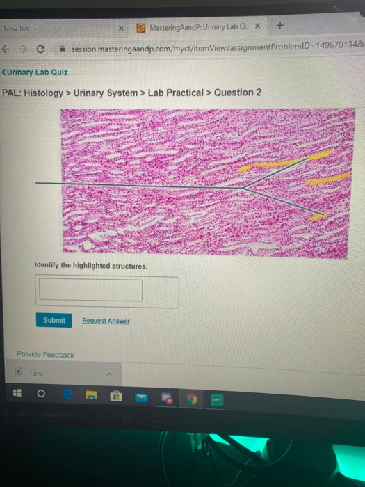 Solved New Tab MasteringAandP: Urinary Lab Qu X + | Chegg.com