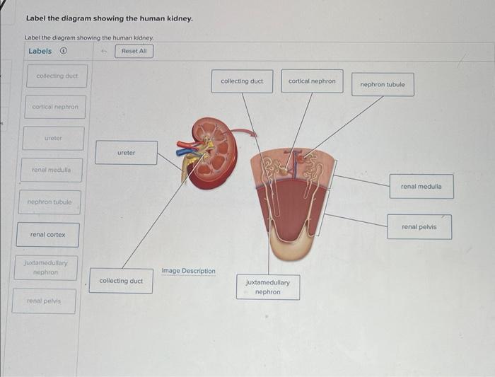 Solved Label the diagram showing the human kidney. Label the | Chegg.com