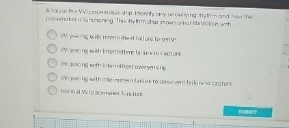 Solved Analyze this VVI pacemaker strip. Identify amy | Chegg.com
