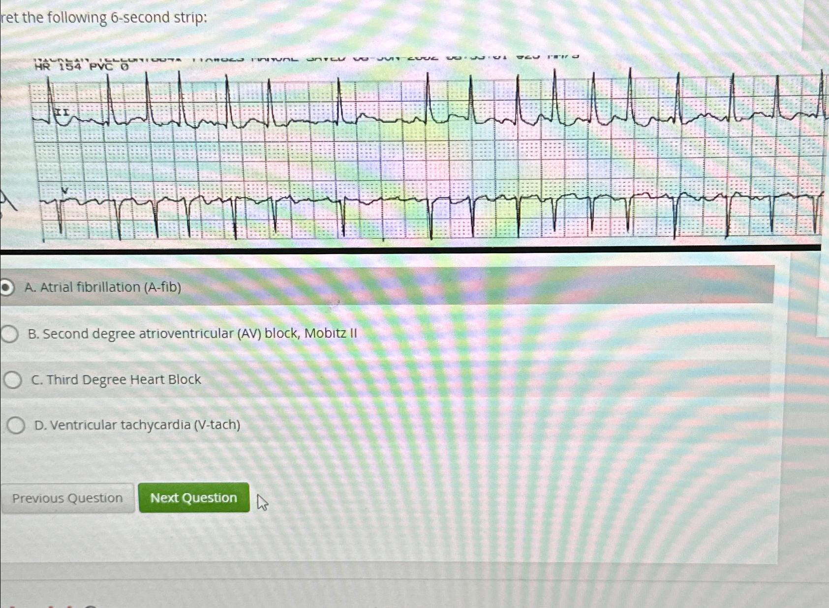 Solved ret the following 6-second strip:A. ﻿Atrial | Chegg.com