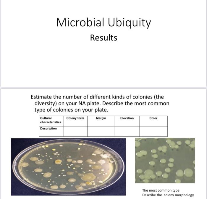 Solved Lab -9 Microbial Ubiquity Х Results: Quantitative | Chegg.com