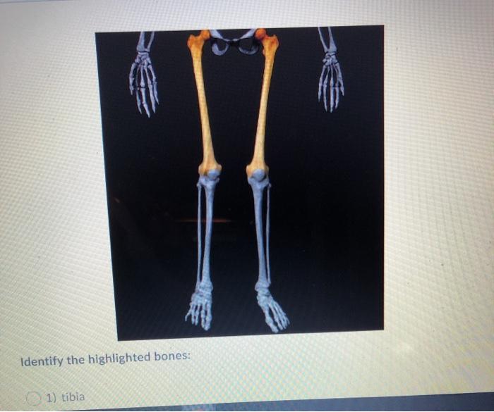 Solved Identify the highlighted bones: 1) tibia | Chegg.com