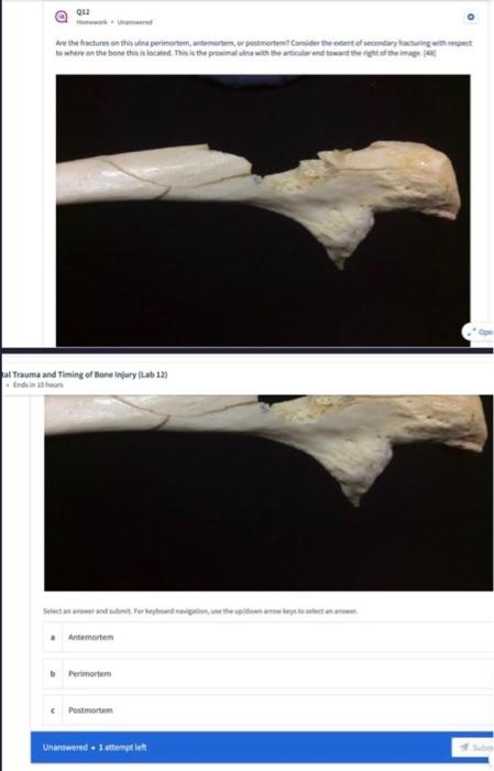 al Trauma and Timing of Bone infury (Lab 12) * Indo | Chegg.com
