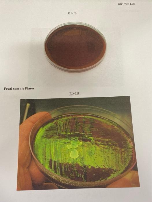 Solved BIO 220 Lab E.M.B Fecal sample Plates E.M.B EMB | Chegg.com