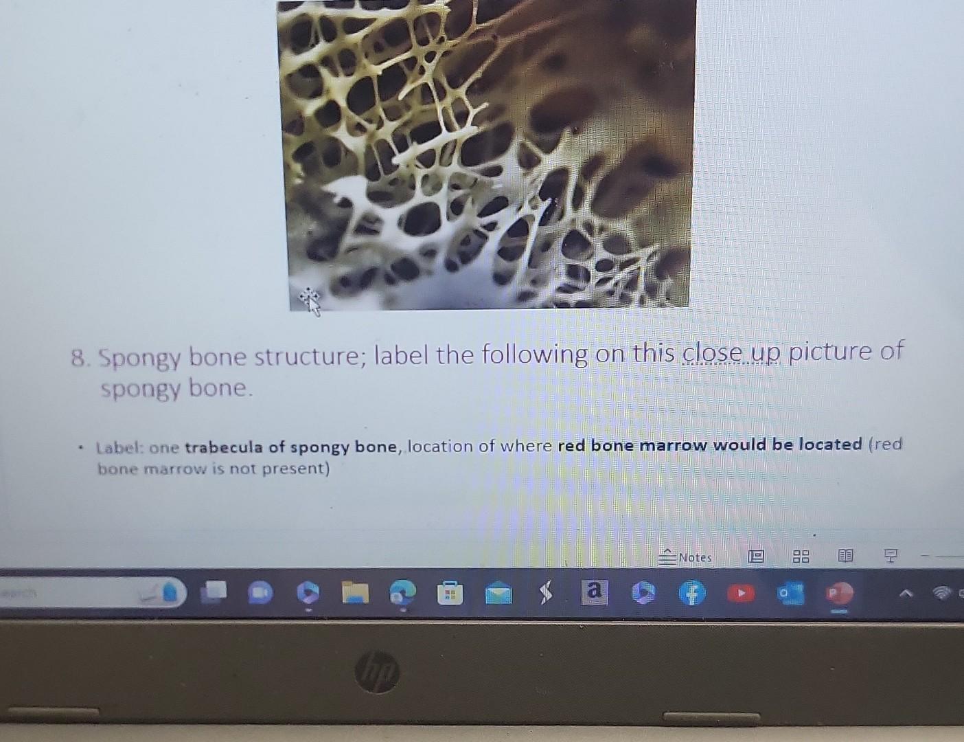 Solved 8. Spongy bone structure; label the following on this | Chegg.com