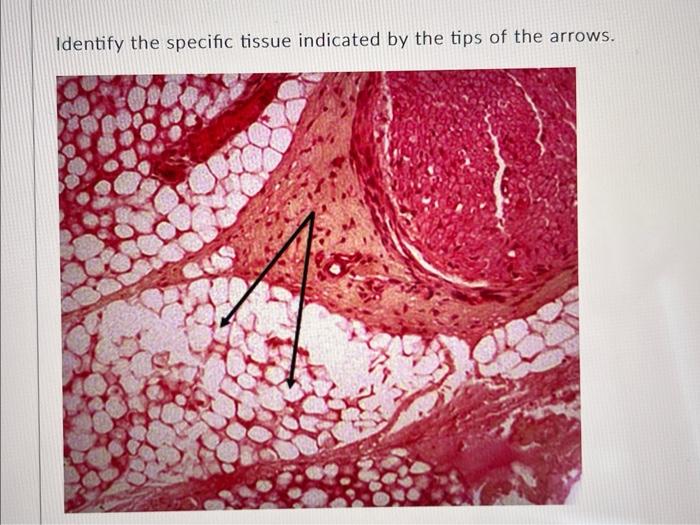 Solved Name the epithelium seen in the image | Chegg.com