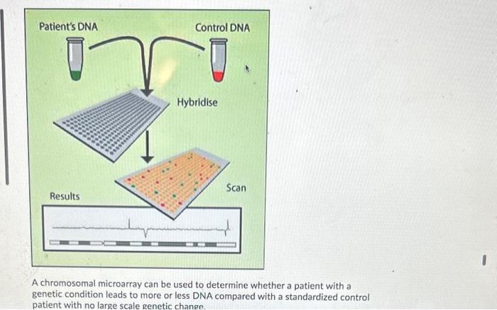 Solved A Chromosomal Microarray Can Be Used To Determine