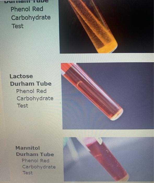 Solved Describe your observations of the 5 carbohydrate | Chegg.com