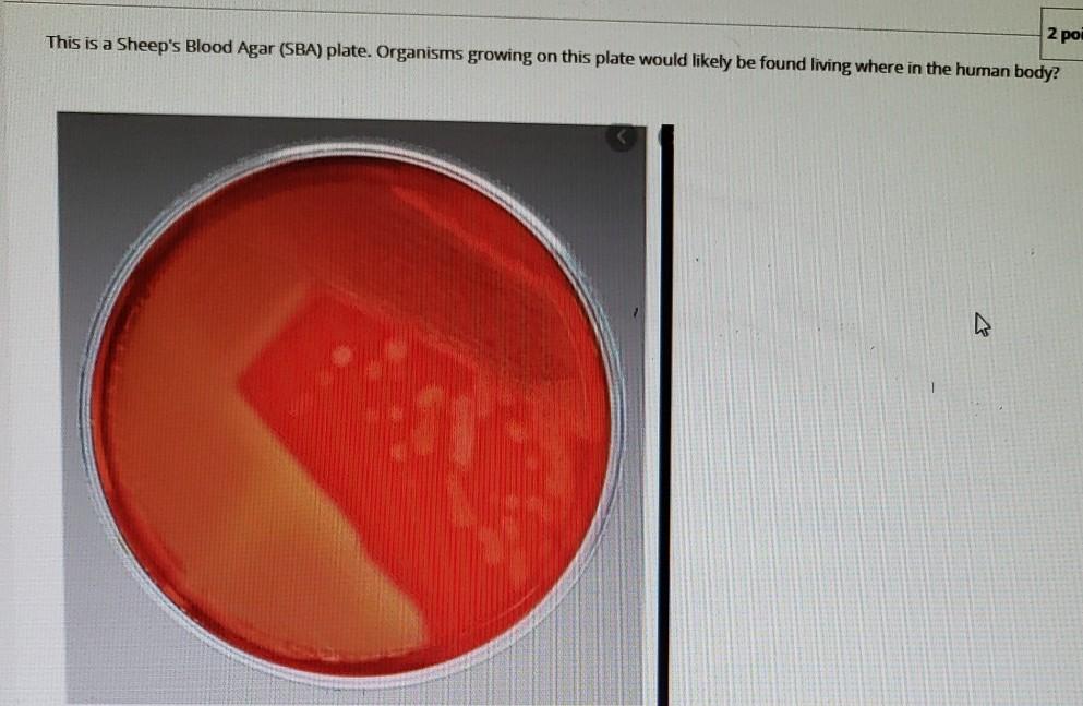 Solved This is a Sheep Blood Agar (SBA) plate. Organisms | Chegg.com